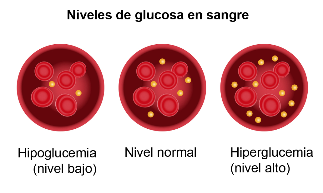 ¿Qué Es La Diabetes? - Lugones Editorial