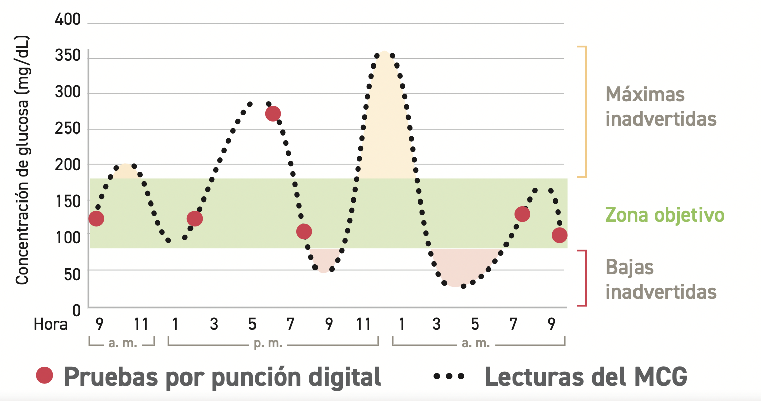 Monitoreo Continuo De Glucosa: Sus Ventajas - Lugones Editorial