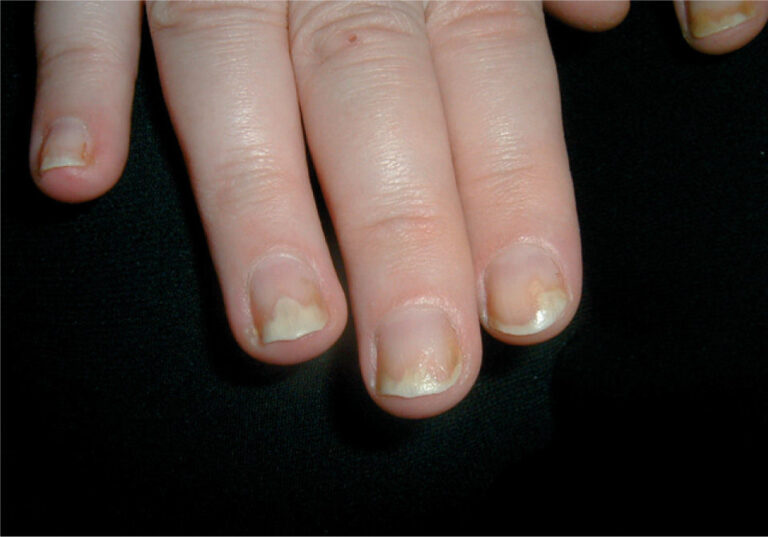 Enfermedades De Las Uñas - Lugones Editorial